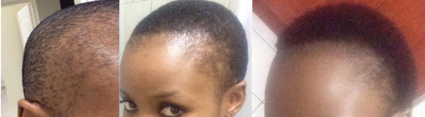 Testimonials - Placenta Plus